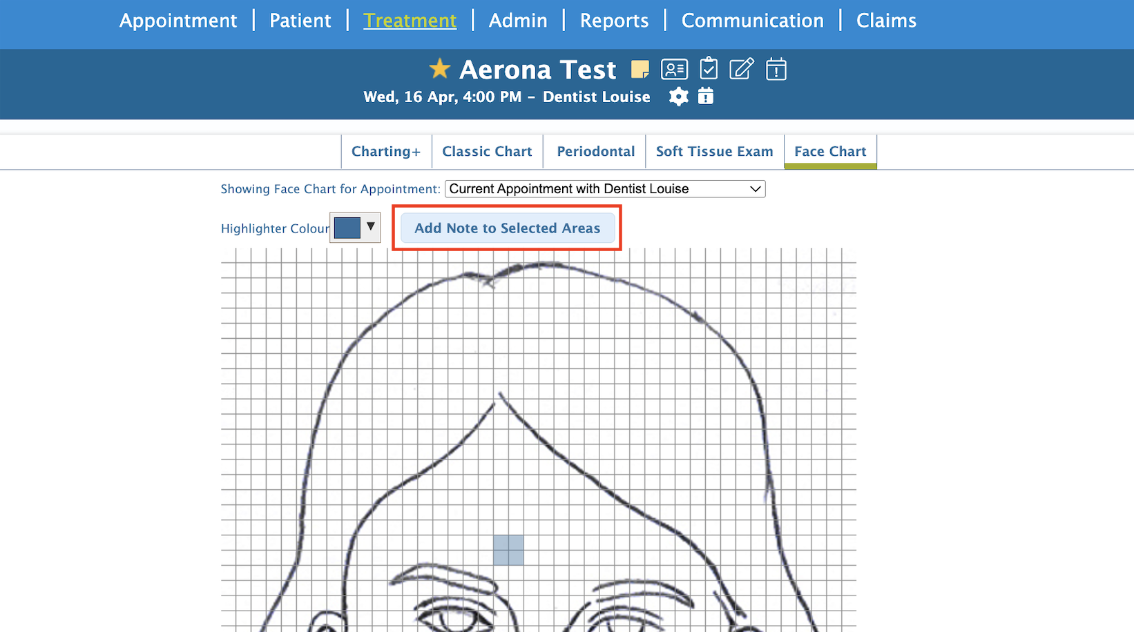 How to Use the 'Face Chart' – Aerona Software